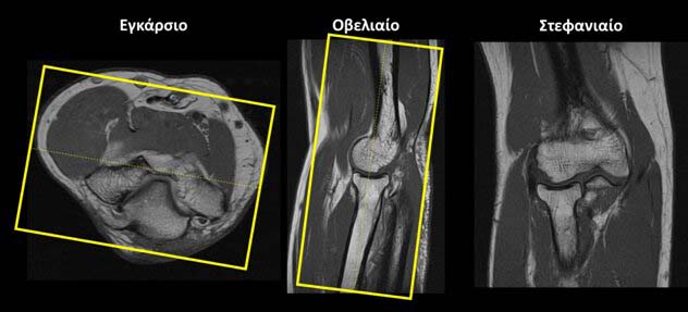 MRI Rad