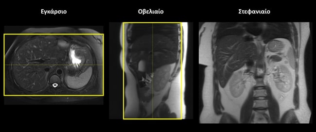 MRI Rad | Μαγνητική Τομογραφία Άνω Κοιλίας