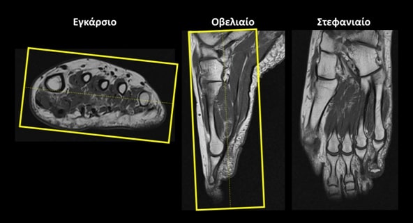 MRI Rad | Μαγνητική Τομογραφία Άκρου Ποδός