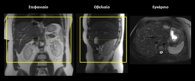 MRI Rad | Μαγνητική Τομογραφία Άνω Κοιλίας