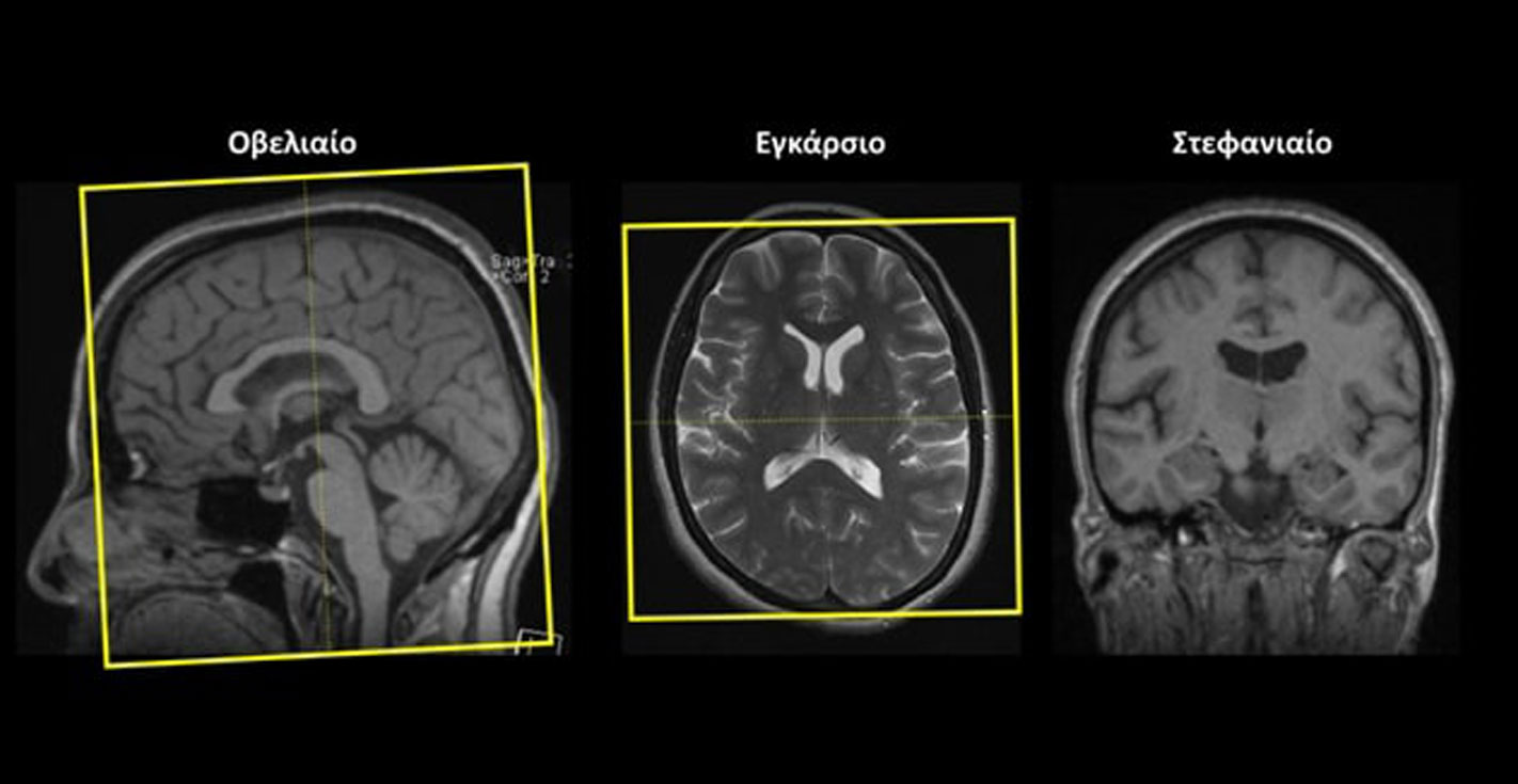 MRI Rad | Μαγνητική Τομογραφία Εγκεφάλου (ρουτίνα)