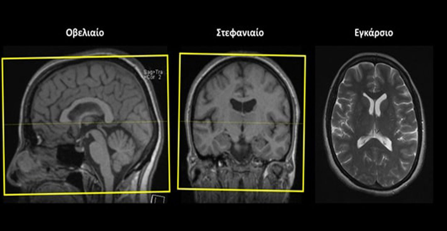 MRI Rad | Μαγνητική Τομογραφία Υπόφυσης