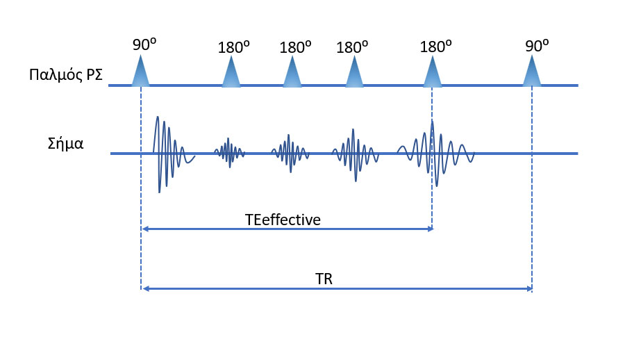 MRI Rad | Ακολουθία παλμών Fast Spin Echo