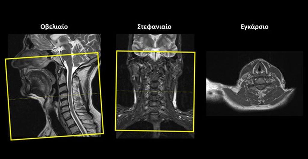 MRI Rad | Μαγνητική Τομογραφία Τραχήλου (soft-tissue neck)