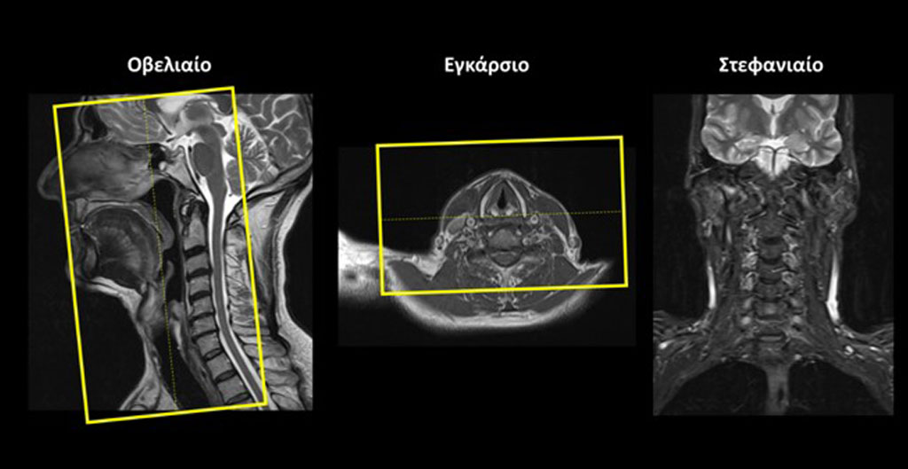 MRI Rad