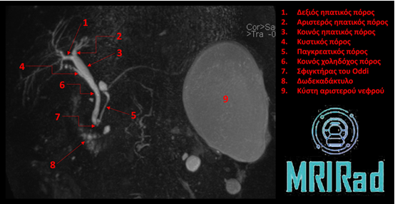 MRI Rad | Μαγνητική χολαγγειοπαγκρεατογραφία (MRCP)